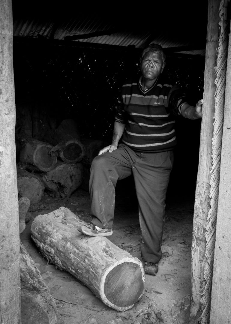 Ed Hanley: Documenting Leprosy in India